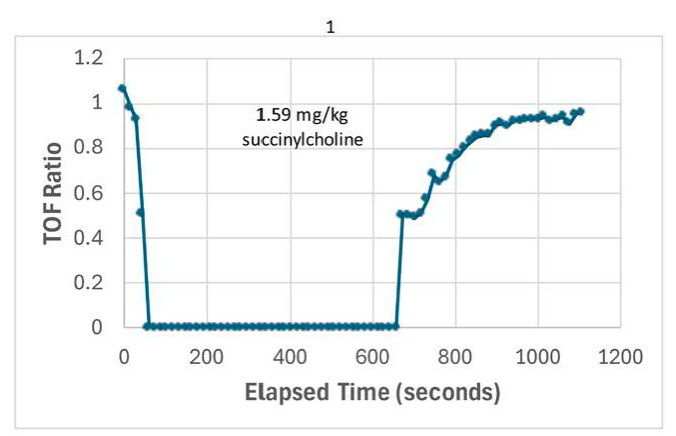 The Myth of Phase 1 and Phase 2 Block From Succinylcholine