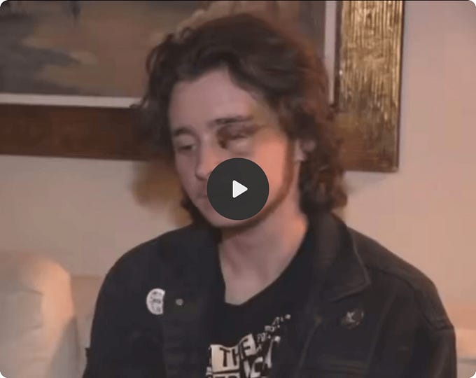 Tom Hoefling (@tomhoefling): "I think this is the young man ICE injured ...