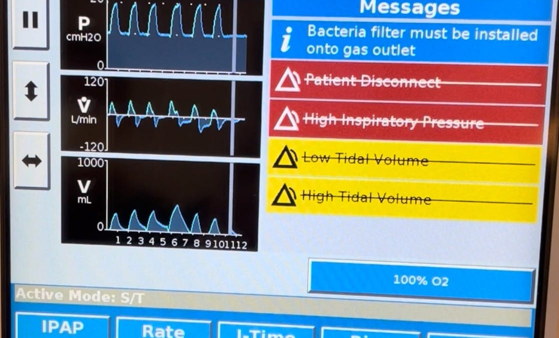 CPAP, BiPAP, AVAPS, HFNC – Which One Does Your Patient Need?