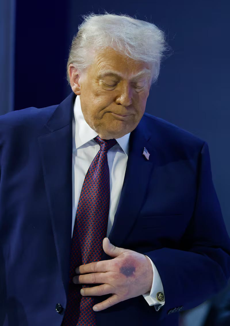 STOP! STOP eff in fixation on POTUS Trump's hand please, stop smearing ...