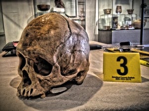 The Paracas Elongated Skulls - Dr. Aaron Judkins Substack