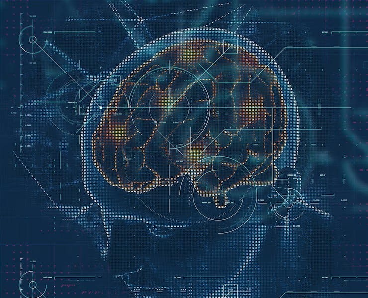 Cryopreservation of the Brain by Vitrification