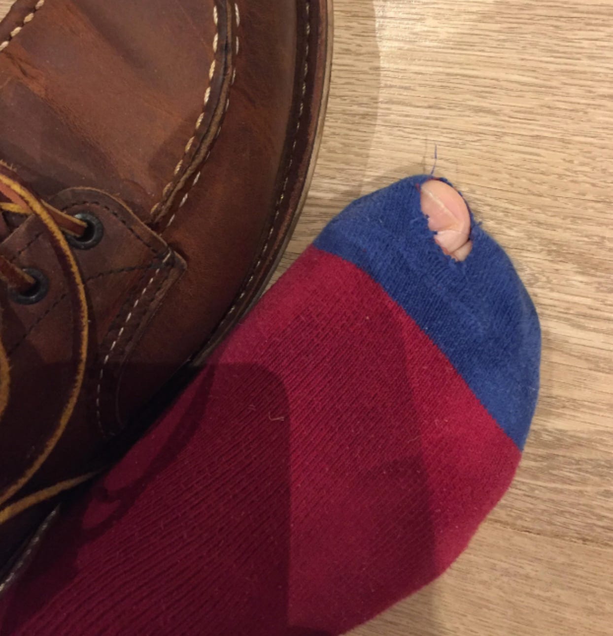 I showed my friend a picture of my toe - by Harrison Moore
