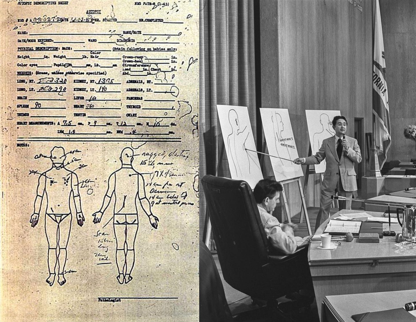 Crime Scene Forensics: Comparing the Autopsies of RFK and JFK