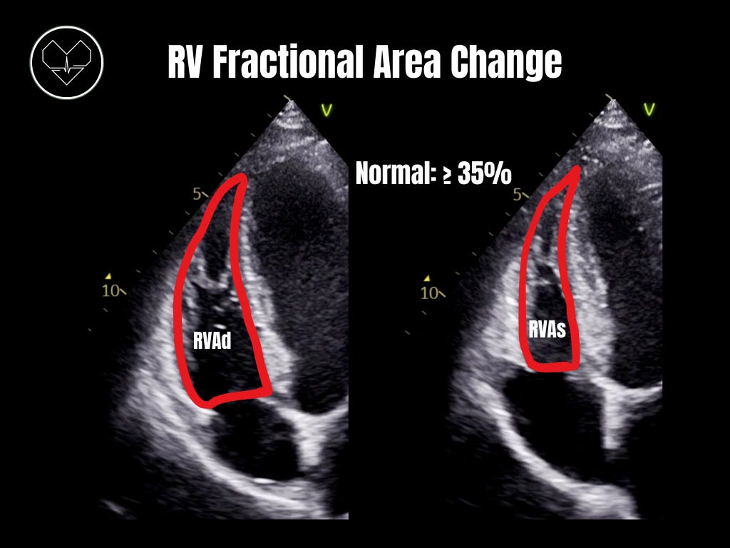 Fractional Area Change - by Aram K. - The Echo Journal