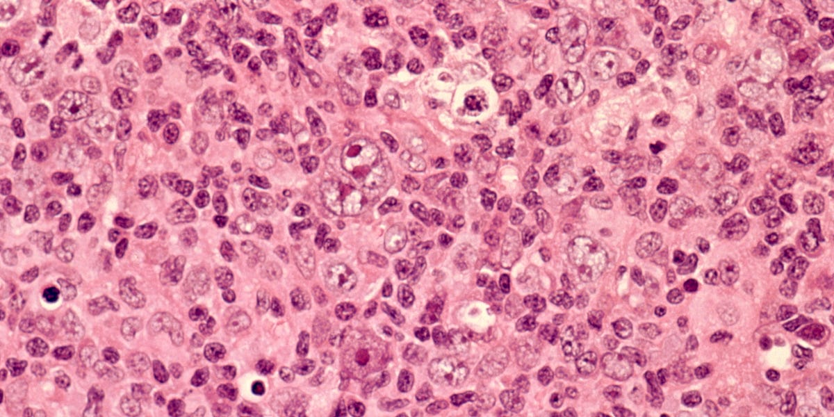 Anatomy of a Viral Substack Note - by Daniel Puzzo