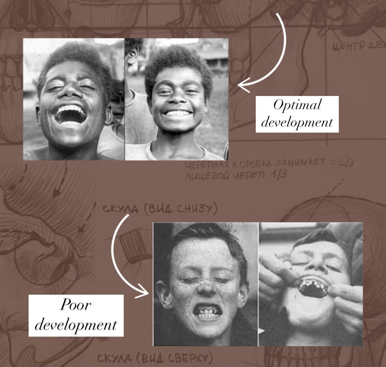 Beauty + Health Part 1: The Maxilla