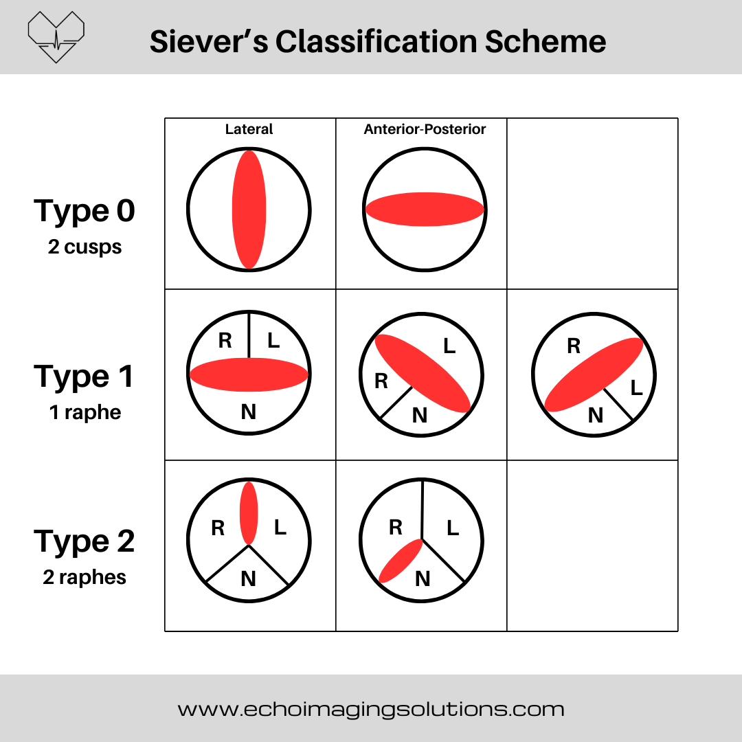 Types of Bicuspid Aortic Valve - by Aram K.