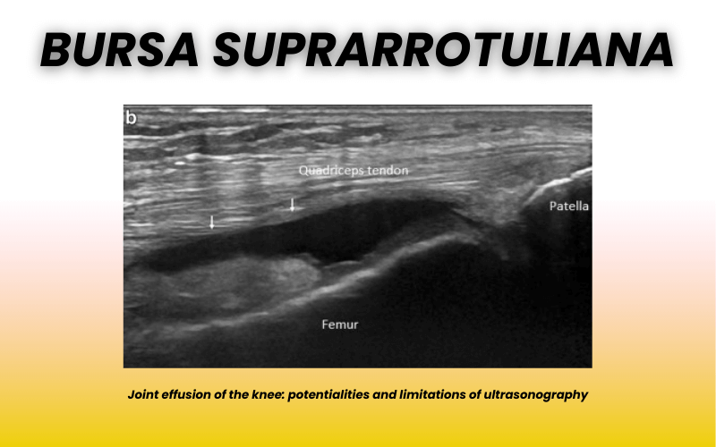 Ecografía y patología de la rodilla - by Tempo Formación