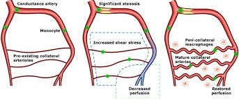 Natural Bypasses: The Body’s Secret Defense Against Blocked Arteries