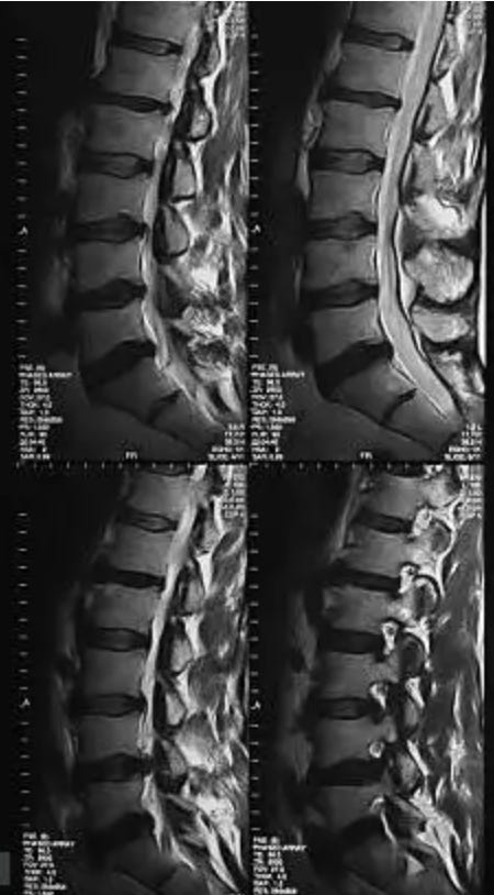 To Scan or Not To Scan? The Full Body MRI Debate