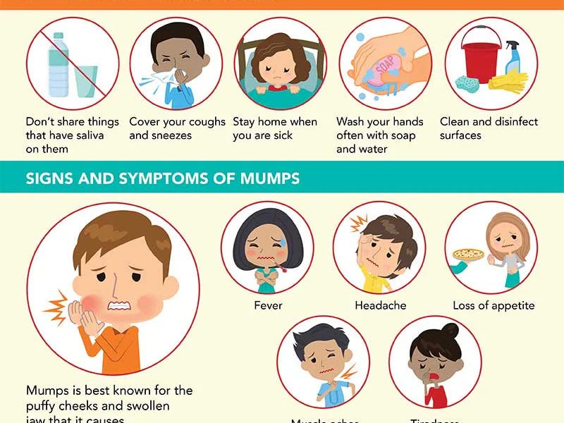 mumps in a child