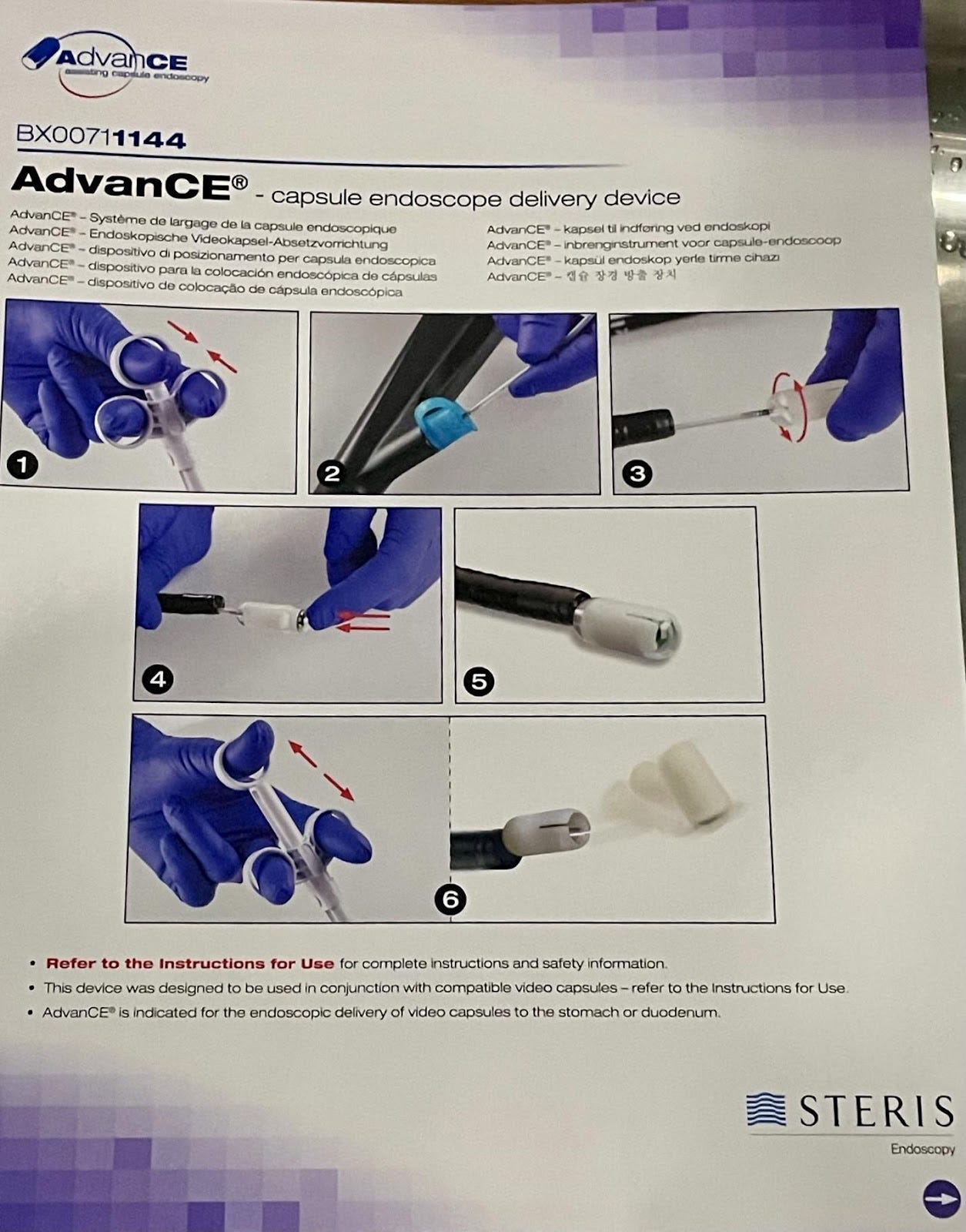 How to Deploy a Capsule Endoscope During EGD