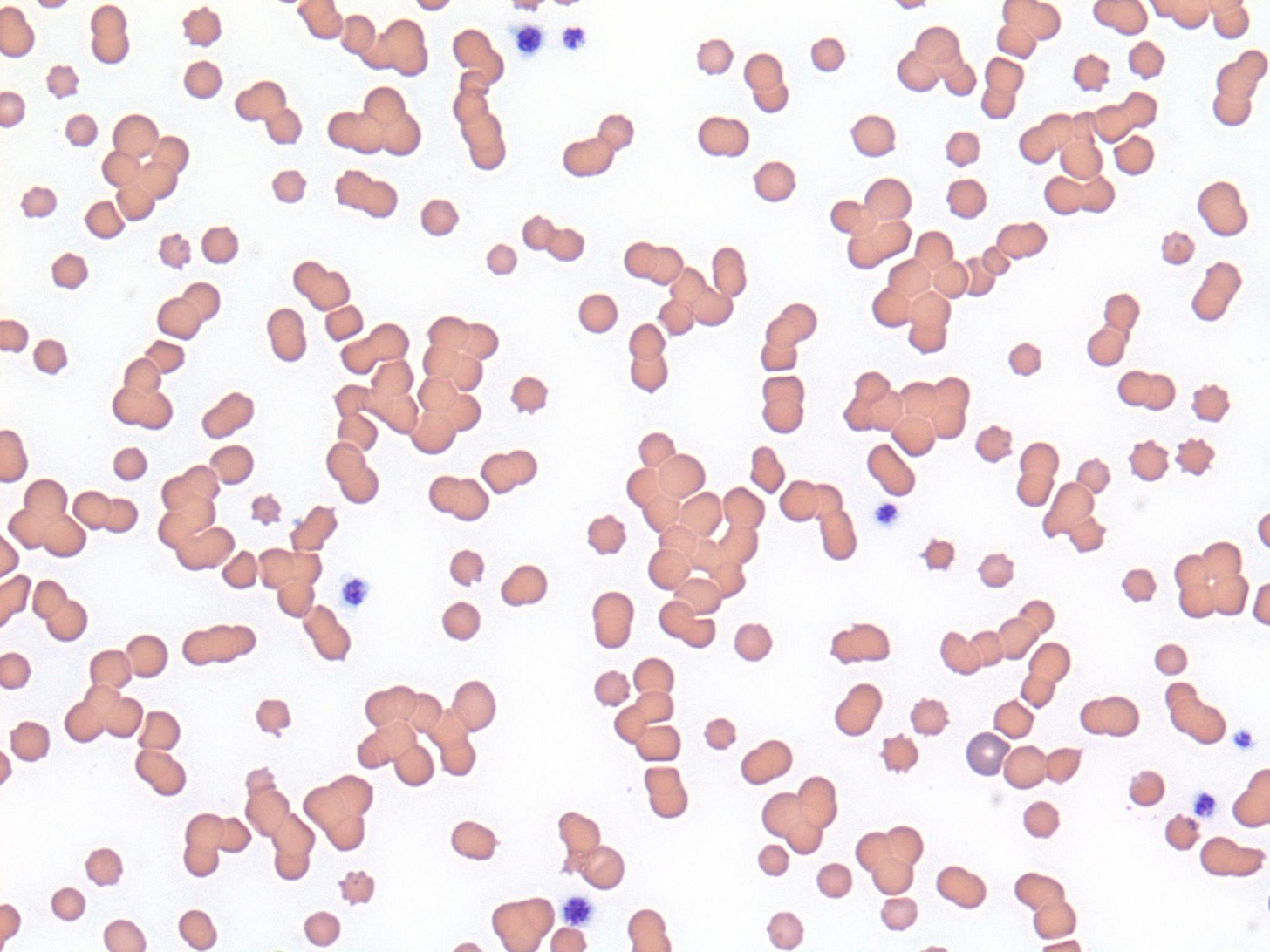 What's the Deal with the Saline "Agglutination" Test?