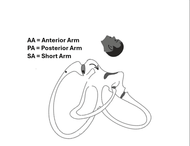 Part 3: Semicircular Canal Anatomy: A Crucial Aspect for Vestibular ...