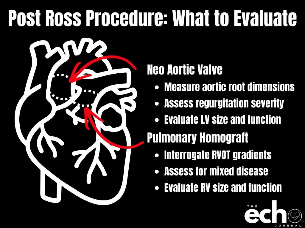 The Ross Procedure: One Patient, Two Valves - by Alex C.
