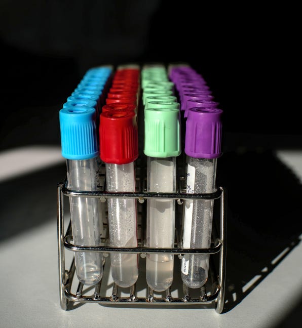 The Order of Draw Series: Part Five - EDTA Tubes