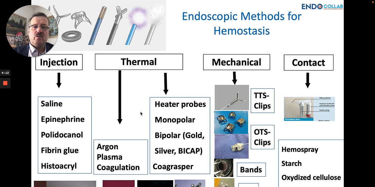 Master Post-Polypectomy Bleeding: An Endoscopist's Guide to Prevention ...