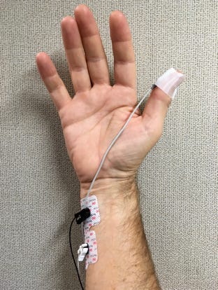 It's time to say goodbye to acceleromyography