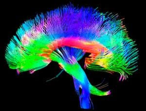 The Six Layers of the Cortex - by Andy Haymaker