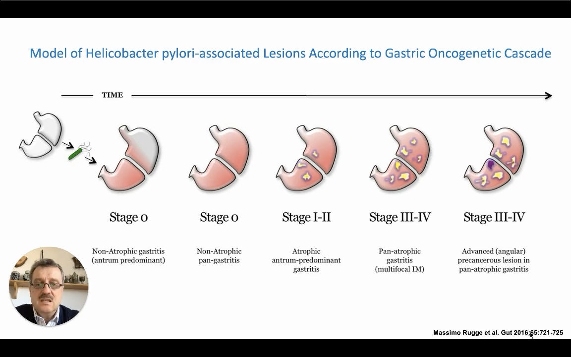Sydney Protocol for Stomach Biopsies