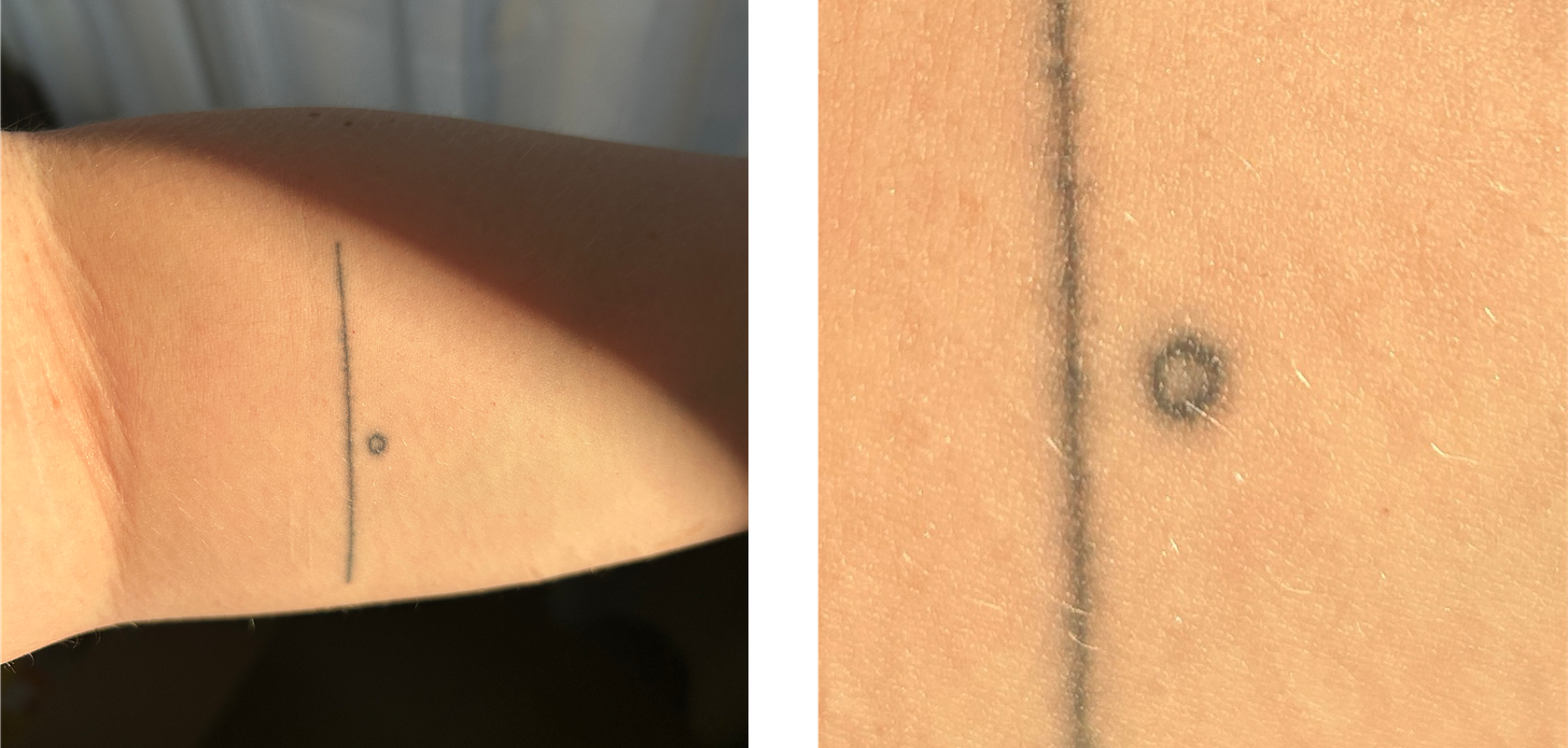 small tattoo problems