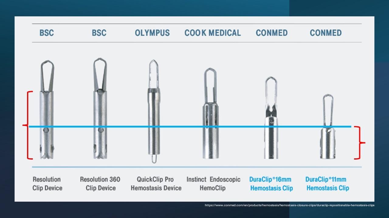 Endoscopic Management of Post-Sphincterotomy Bleeding: Eight Hemostatic ...