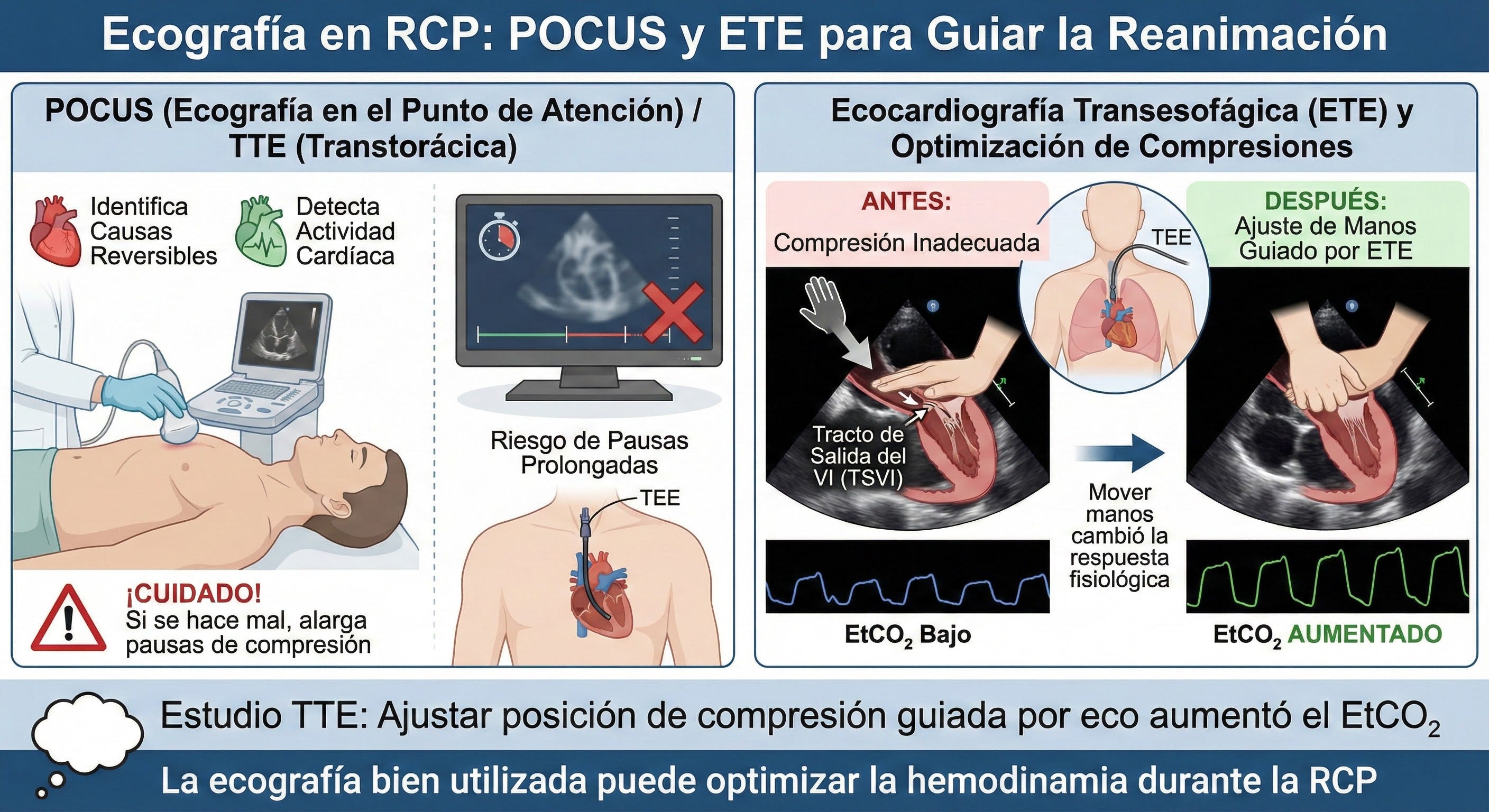 RCP guiada por fisiología: reanimar con presión, no con fe