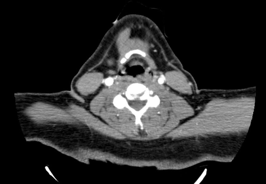 CTA Head/Neck Images from Locked-In Case