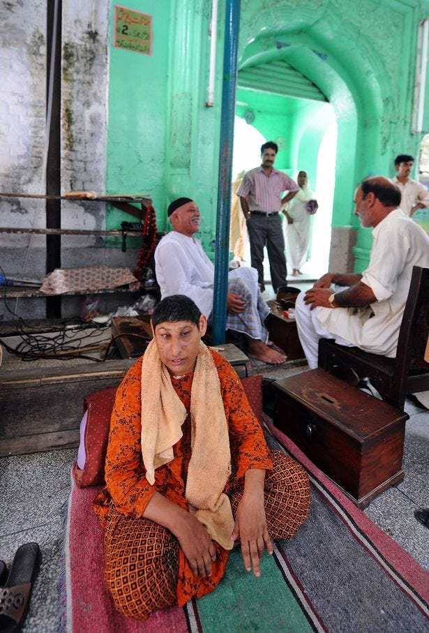 The Shrine of Abandonment: The "Rat Children" of Shah Daulah, Pakistan