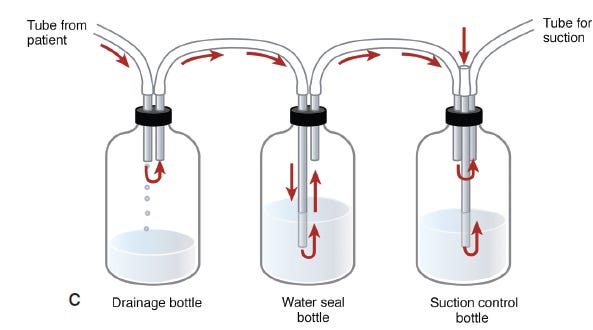 Chest Tubes & Pigtails: 5 Must-Know Tips for ICU Rotation