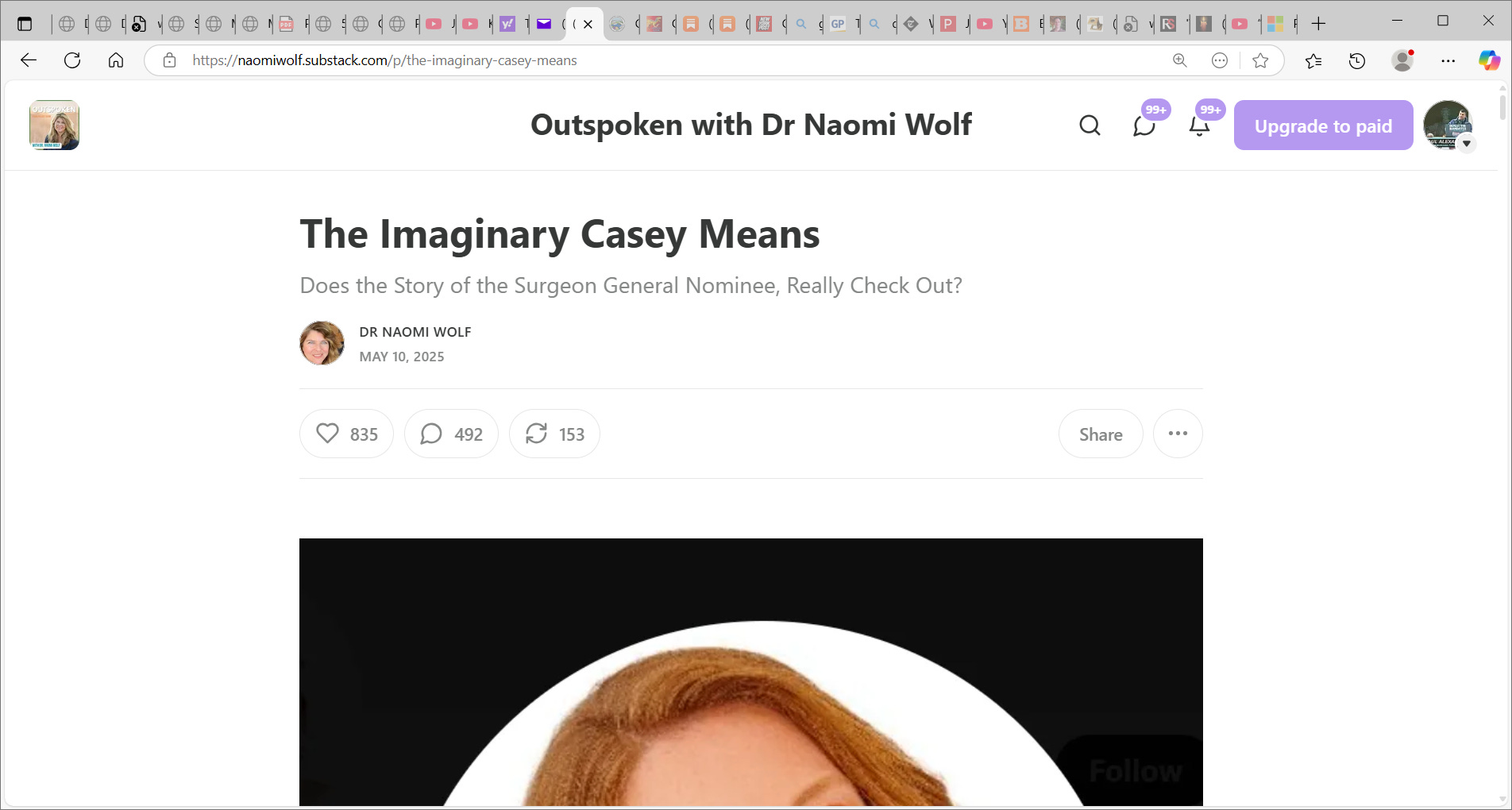Dr. Naiomi Wolf delivers a well written, deep study on the Surgeon ...
