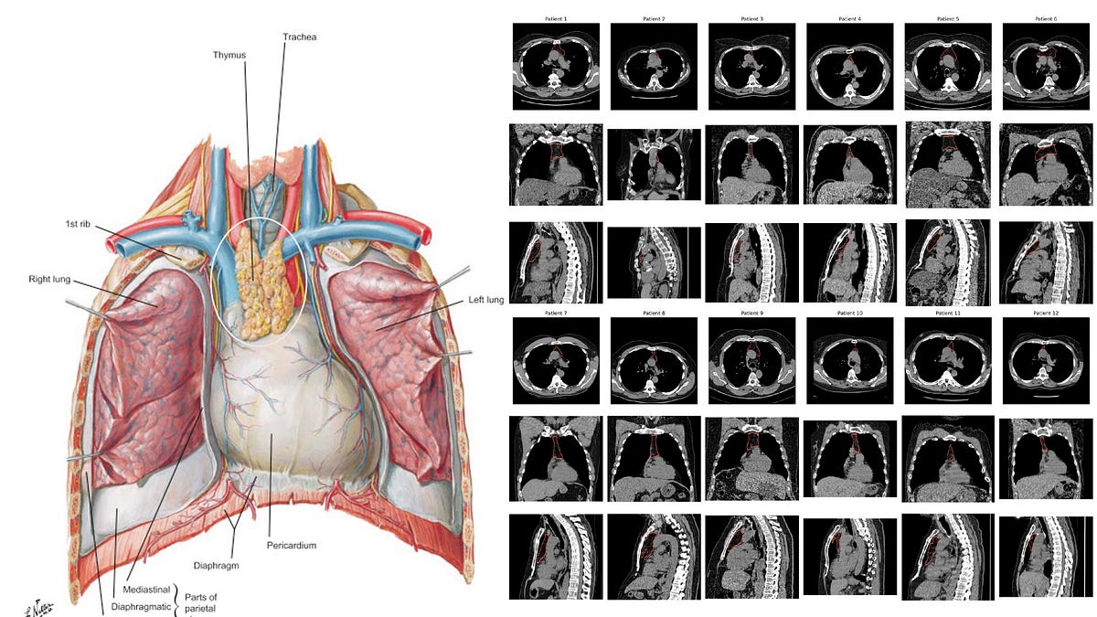 Your Thymus and Your Healthspan - by Eric Topol
