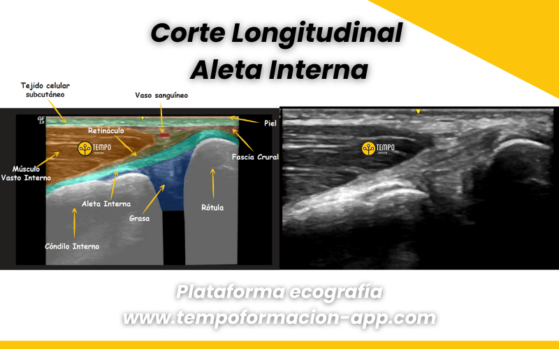 Anatomía y ecografía en rodilla - by Tempo Formación