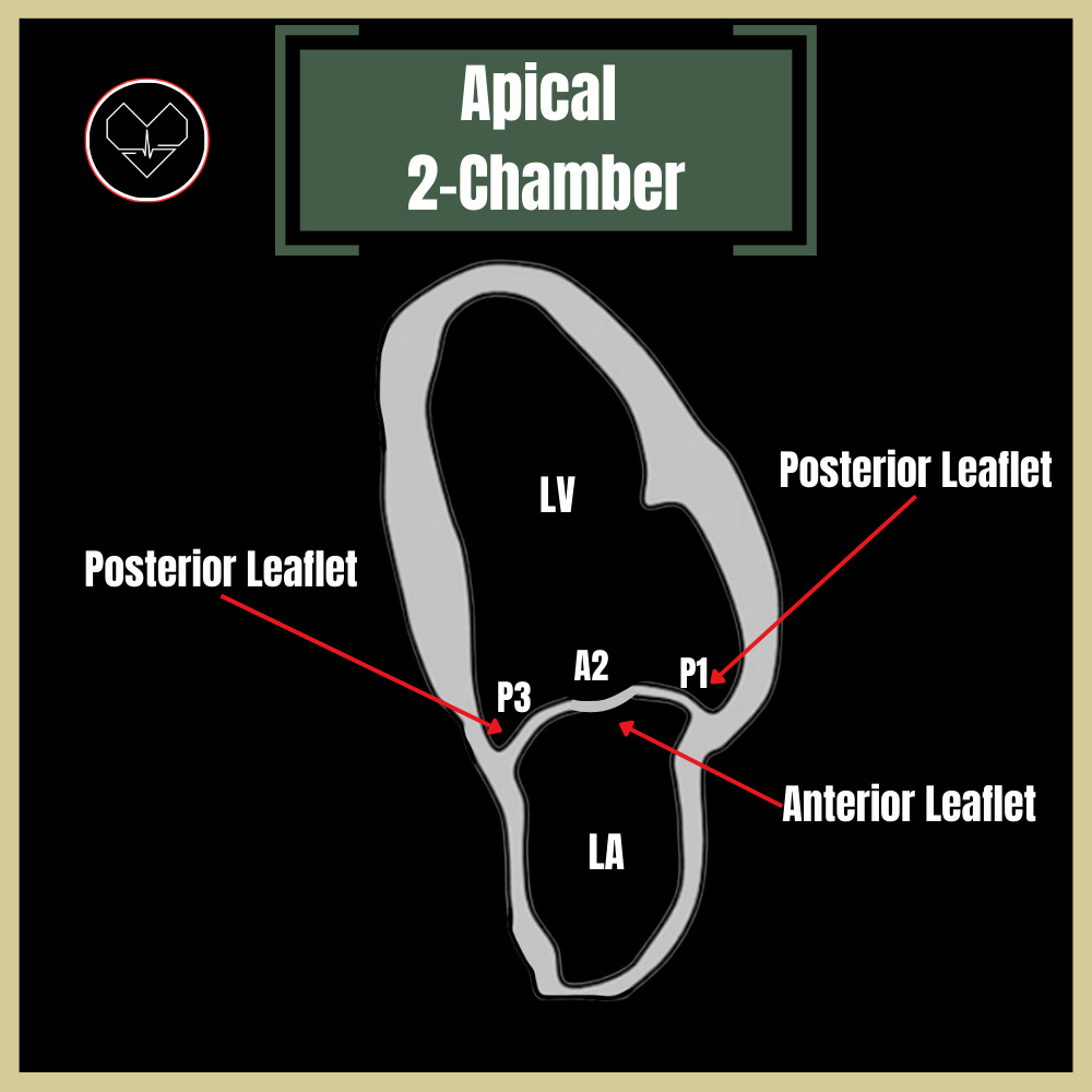 Mitral Valve: Beyond the Basics - by Alex C.