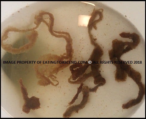 THE ROPEWORM PROTOCOL RESOURCES - by Eating To Ascend