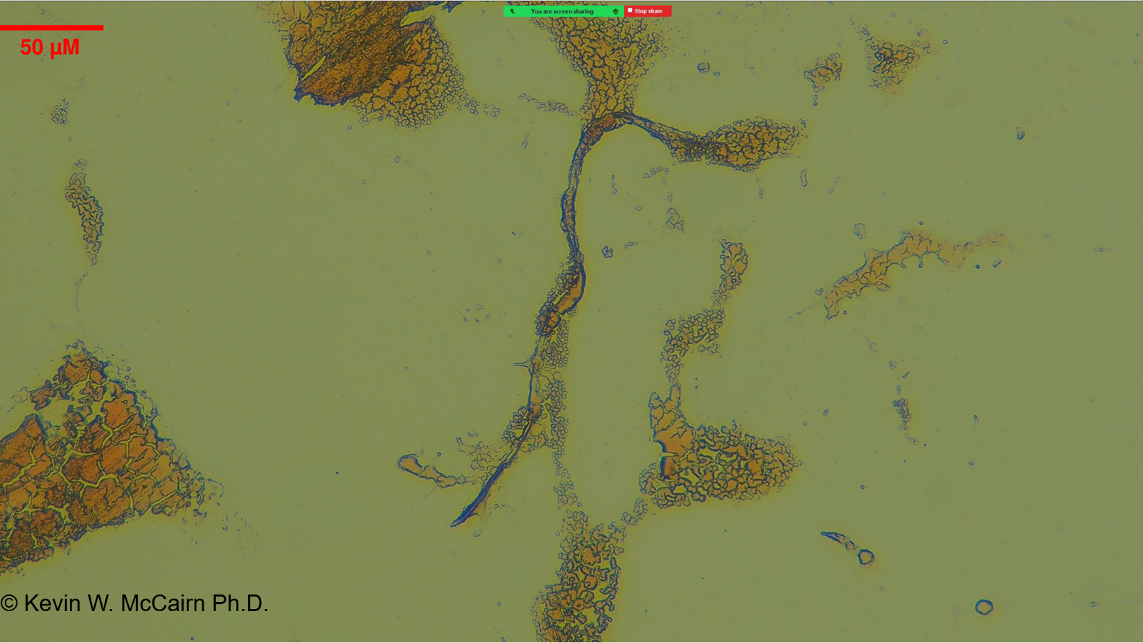 Ground Zero Plus Exclusive - Dr. Kevin W. McCairn's Latest COVID Research