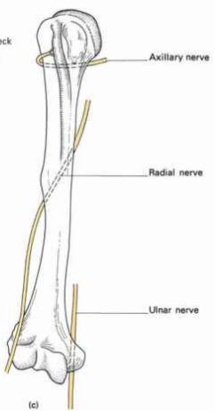 Wrist drop - by Gavin Giovannoni - Teach Neurology