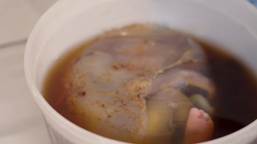 New Details on the 5 Late-Term Aborted Babies Taken from Abortion ...