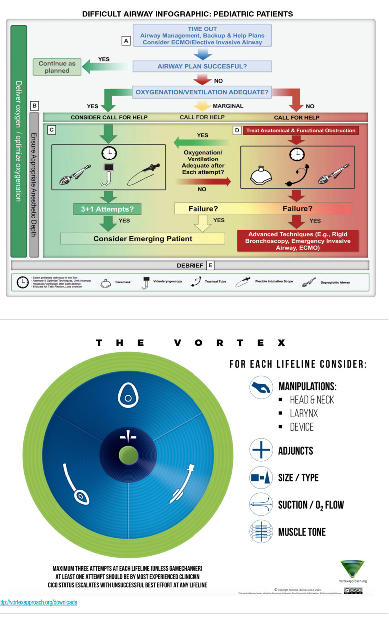 ASA difficult airway NEW guidelines - by Ron Litman