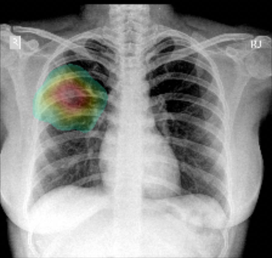 The Evolution of Radiology: AI is the New Physics