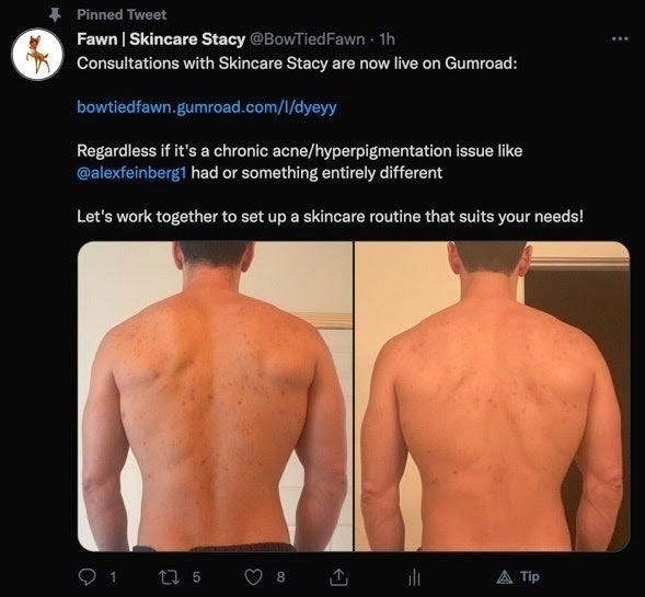 All About Anti-Aging: Our Toolkit - by Fawn B.