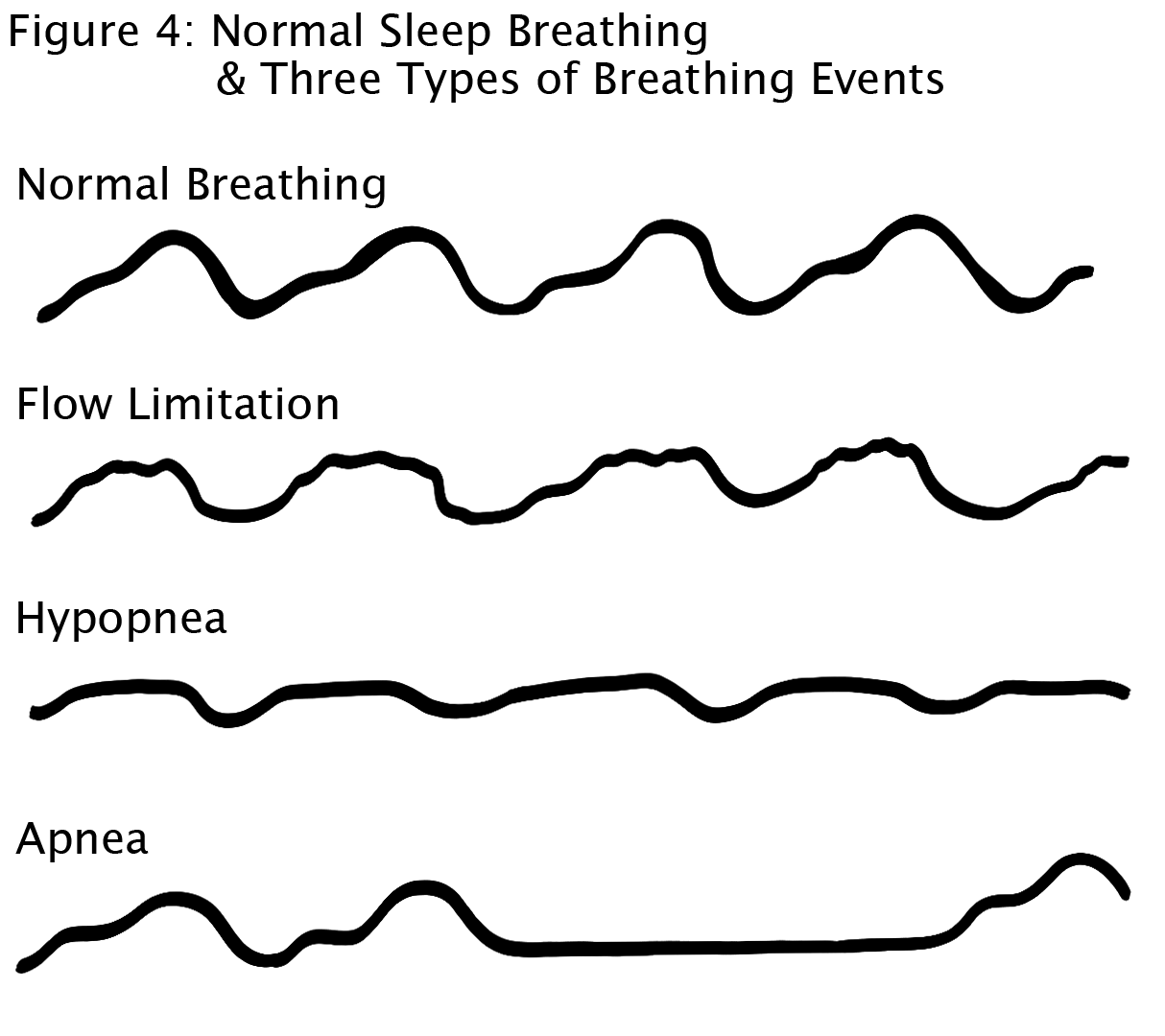 The Third Breathing Event - by Barry Krakow, MD