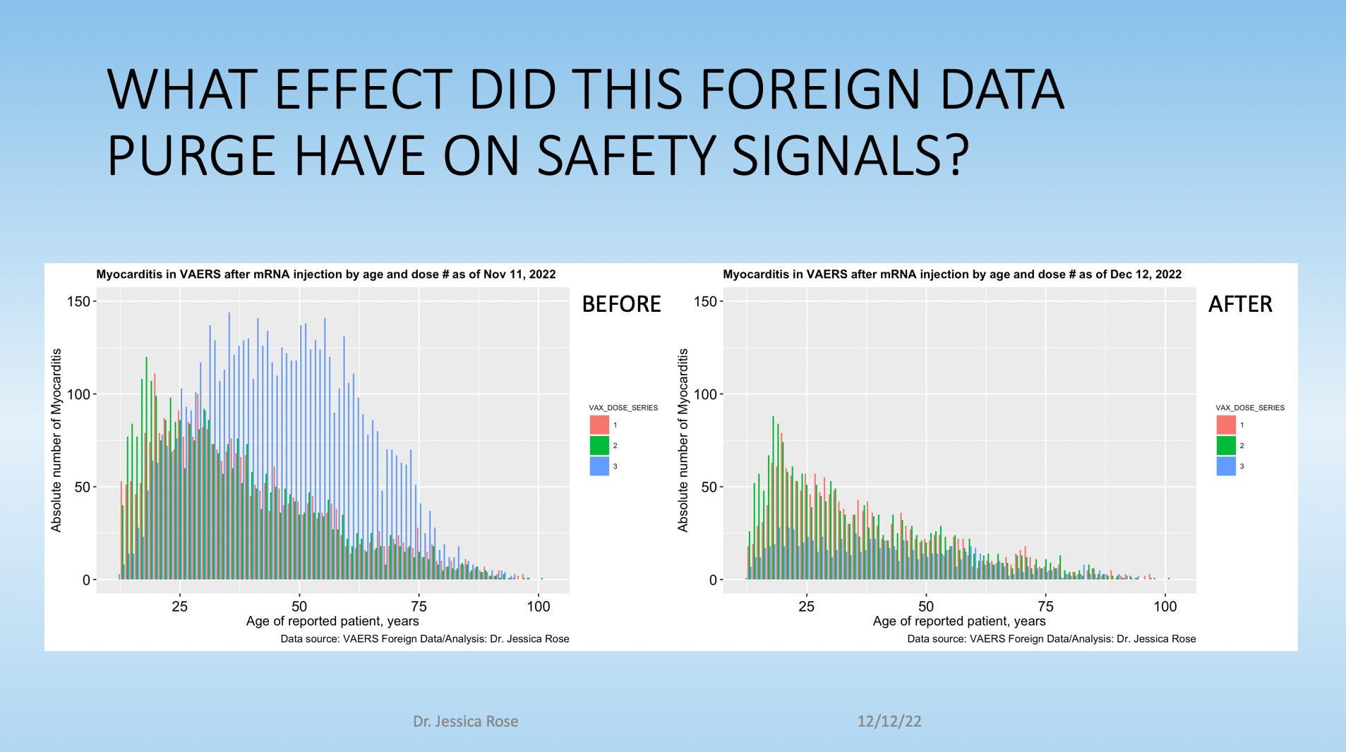 A new development in the FOREIGN DATA PURGE missing myocarditis signal ...