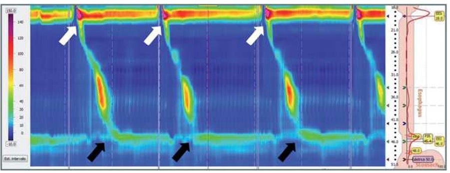 Enfermedades del esófago - by Harold Ferraz
