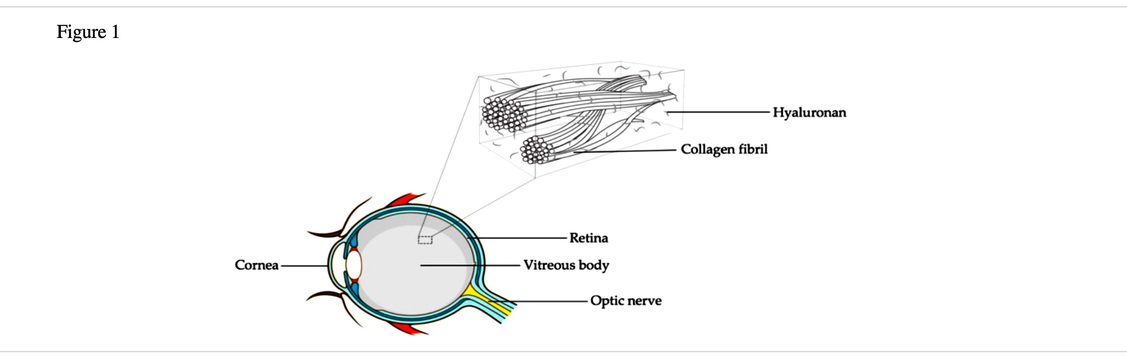 What are Eye Floaters Part I - by Karen Langston