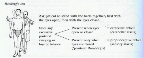 Cerebellar ataxia and Romberg's test - by Gavin Giovannoni