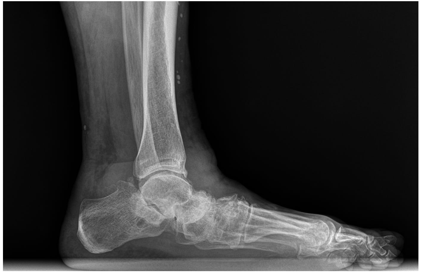 Let's get this party started...