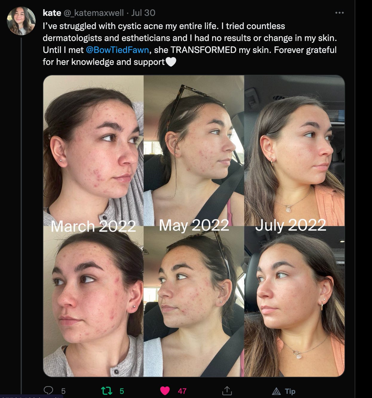 The Ultimate Guide to Perfect Skin - by Fawn B.