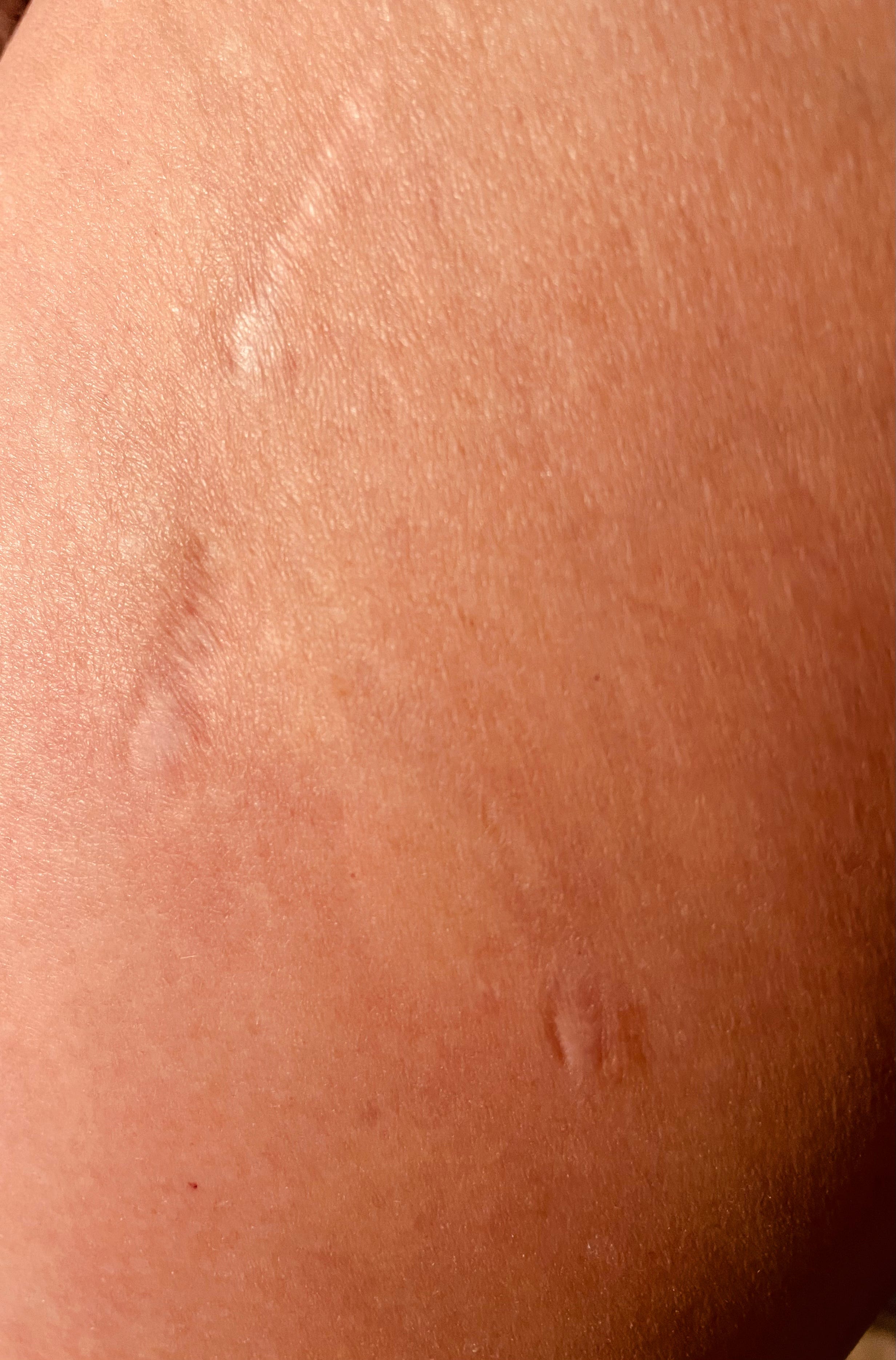 SCARS - by Tanja Boness - Change & Evolve Letter